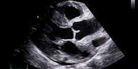 Imaging_Echocardiography
